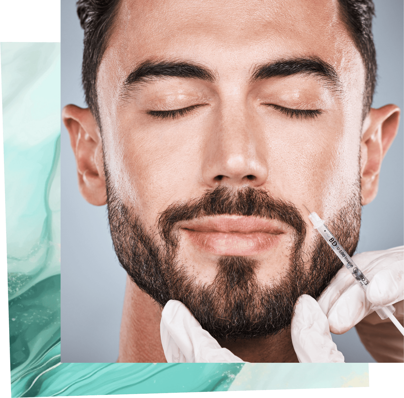 Dermal Fillers - Aria Wellness