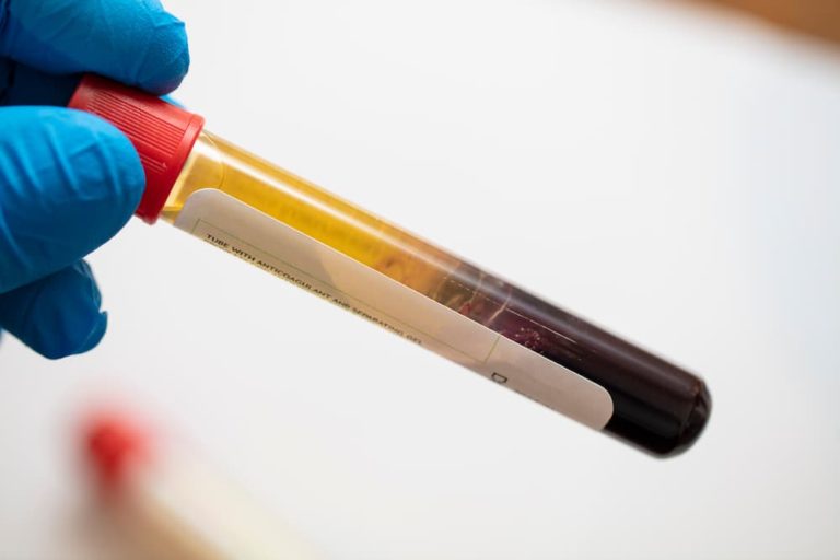 PRP Vs. PRF - What’s The Difference? - Aria Wellness